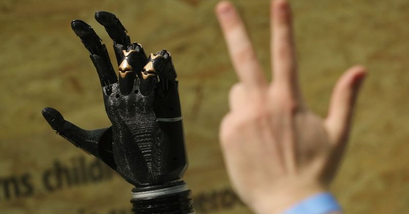 Here's How Prosthetic Startup Psyonic Secured A Million Dollar Deal On ...